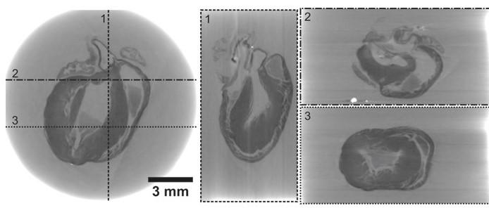 Mouse Heart XPCI imaged